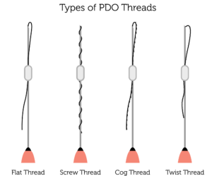 PDO Threads Jawline | Thread Lift London | Rejuvence Clinic