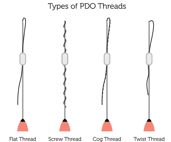 PDO Threads Jawline | Thread Lift London | Rejuvence Clinic